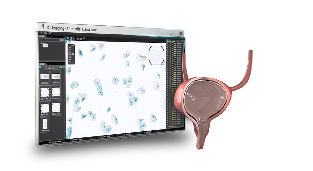 Biomedica Bladder Cancer Screening Kit｜TIE