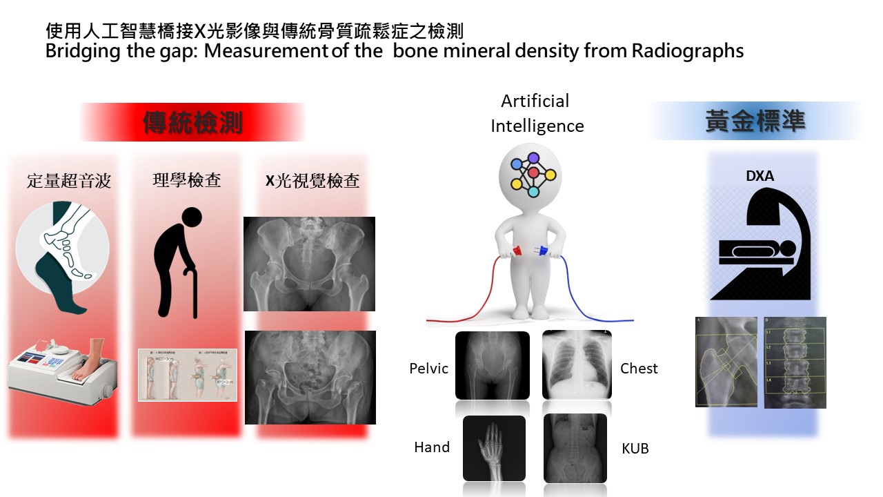 Inference of bone density from X-ray using AI methods｜TIE